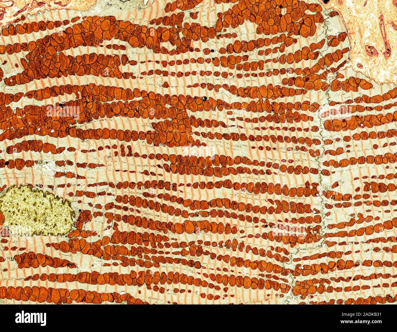 Des cellules du muscle cardiaque. Micrographe de couleur d'une cellule ...