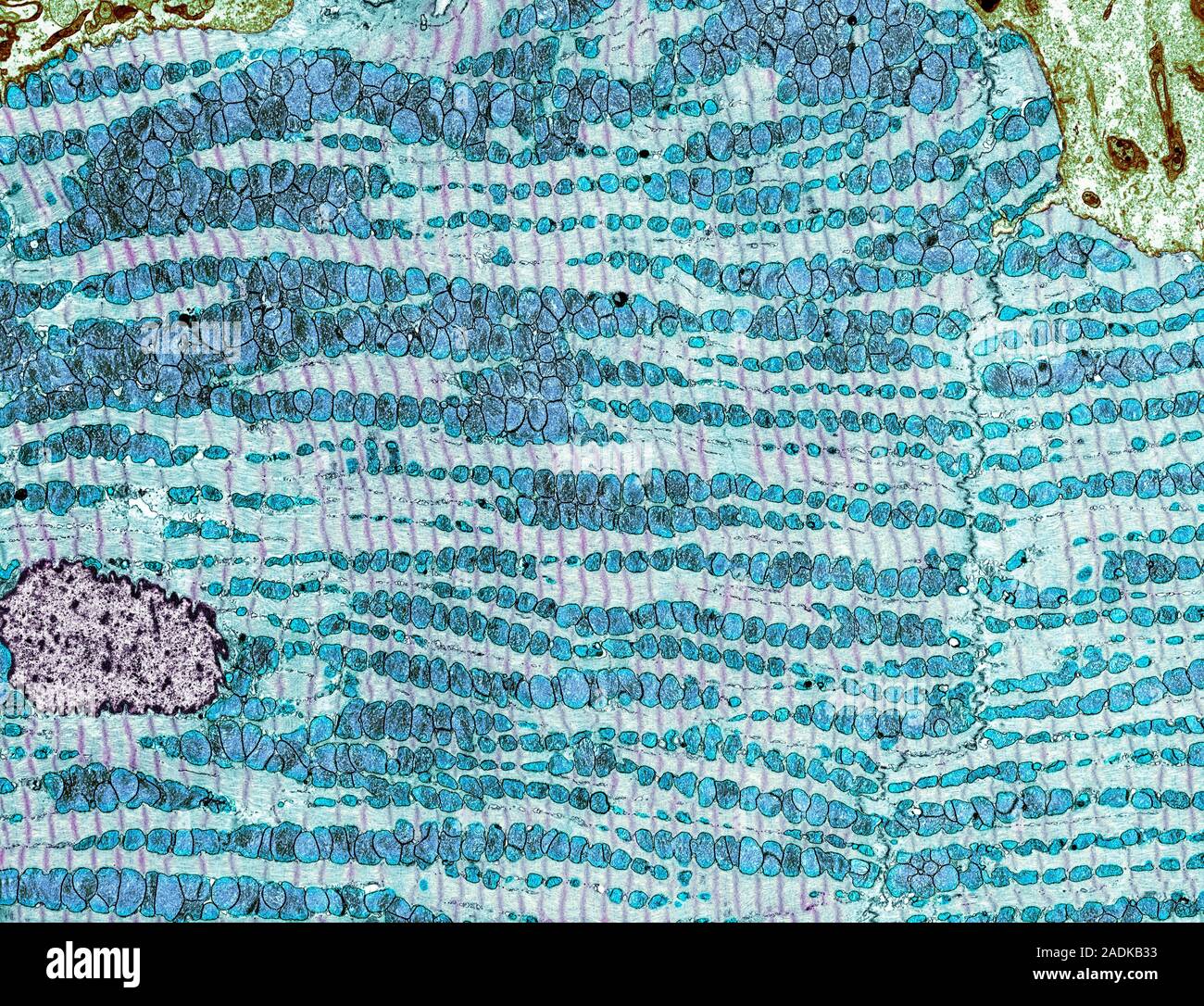 Des cellules du muscle cardiaque. Micrographe de couleur d'une cellule ...