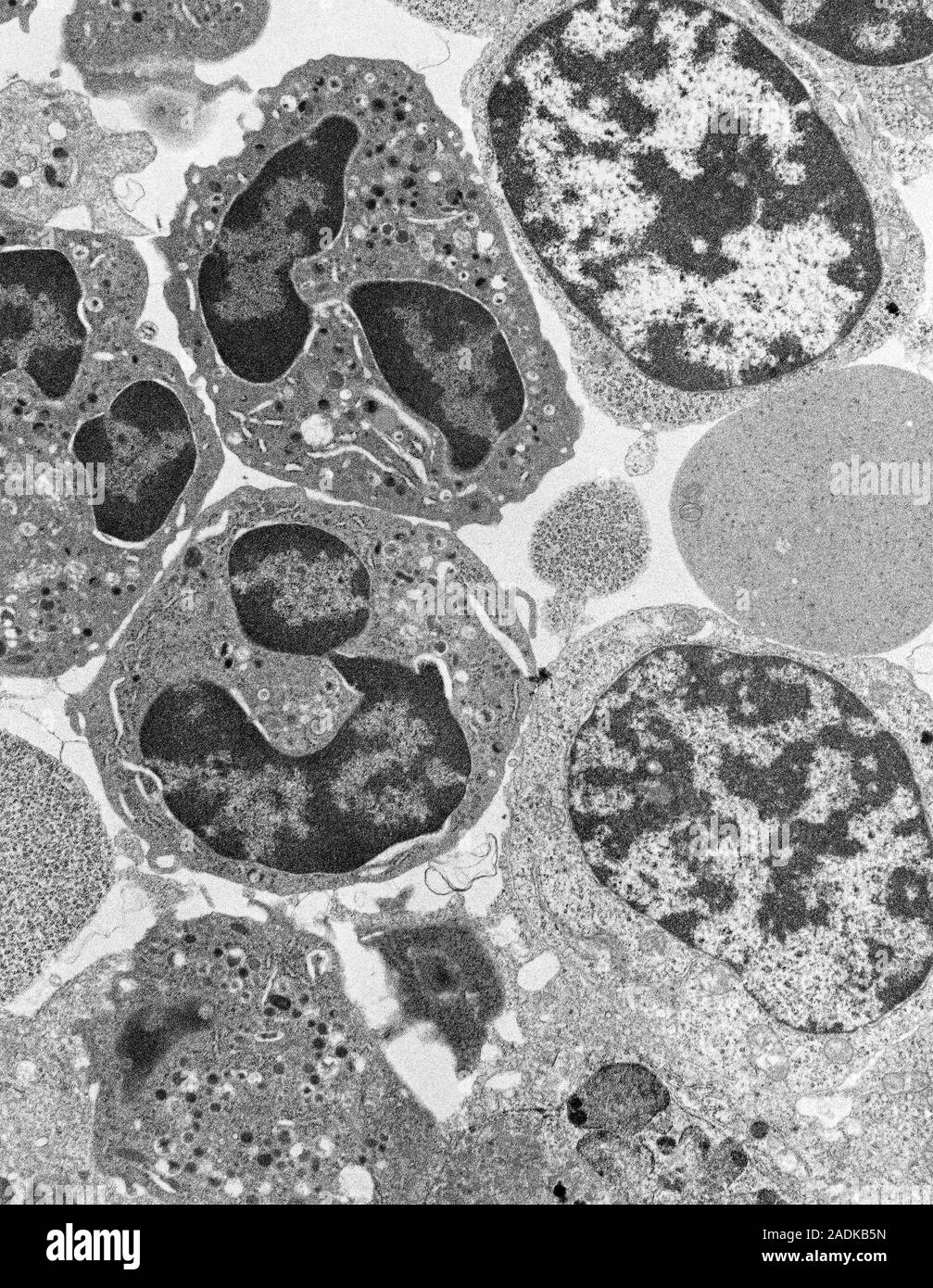 La formation des cellules du sang. Micrographe de précurseurs de ...