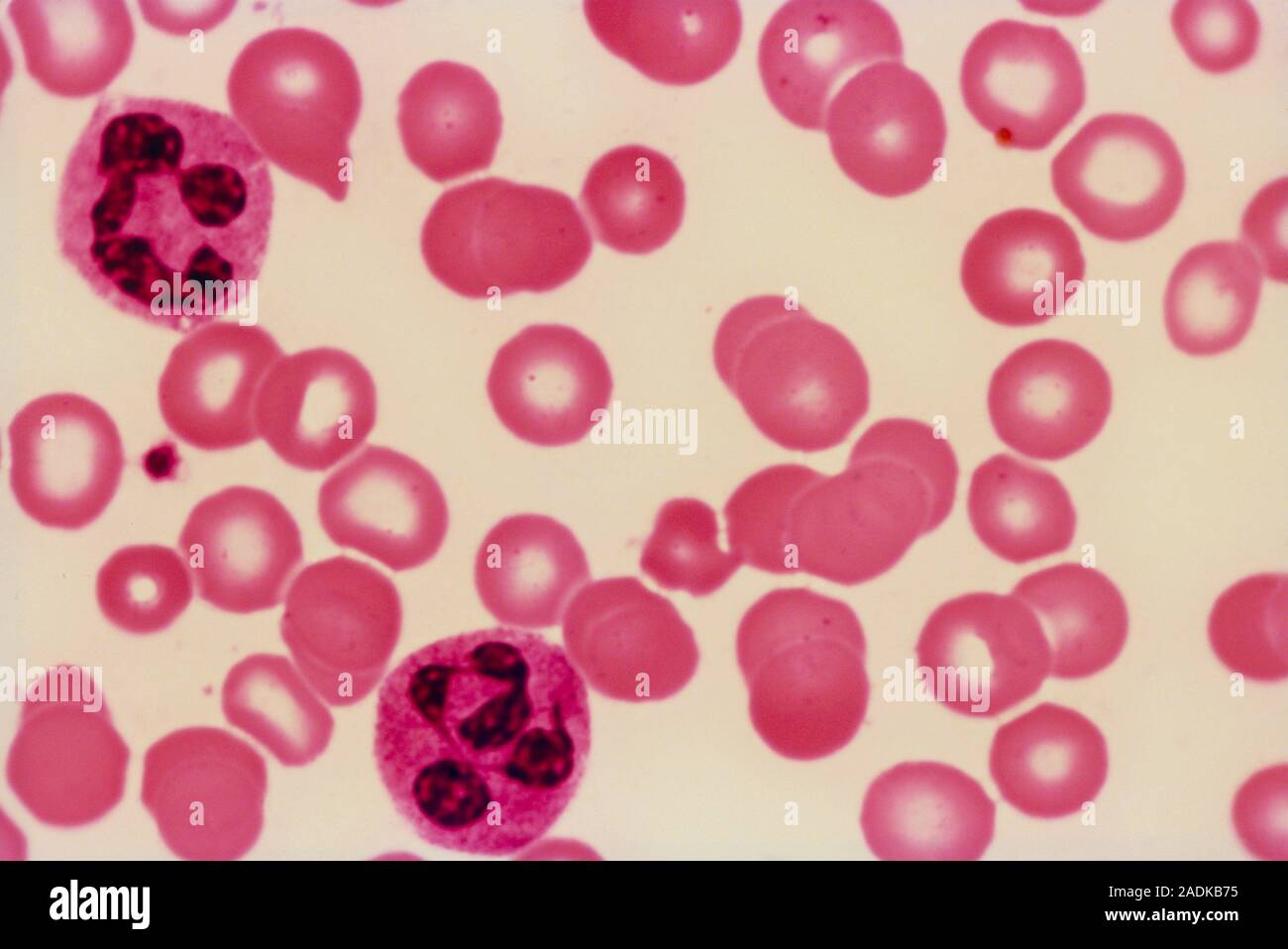 Micrographie de la lumière des cellules sanguines, montrant de ...