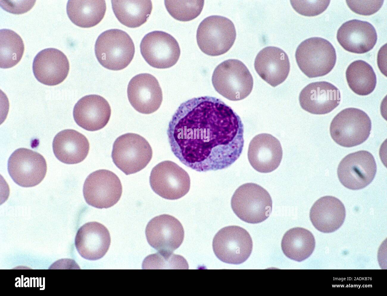 Micrographie de la lumière des cellules sanguines, montrant de ...