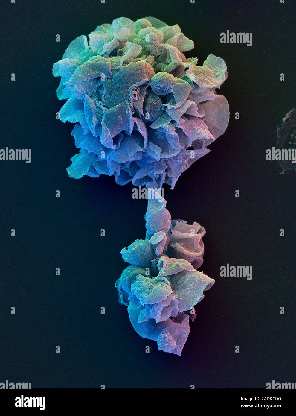 Les macrophages. Couleur de l'analyse des électrons Microphotographie ...