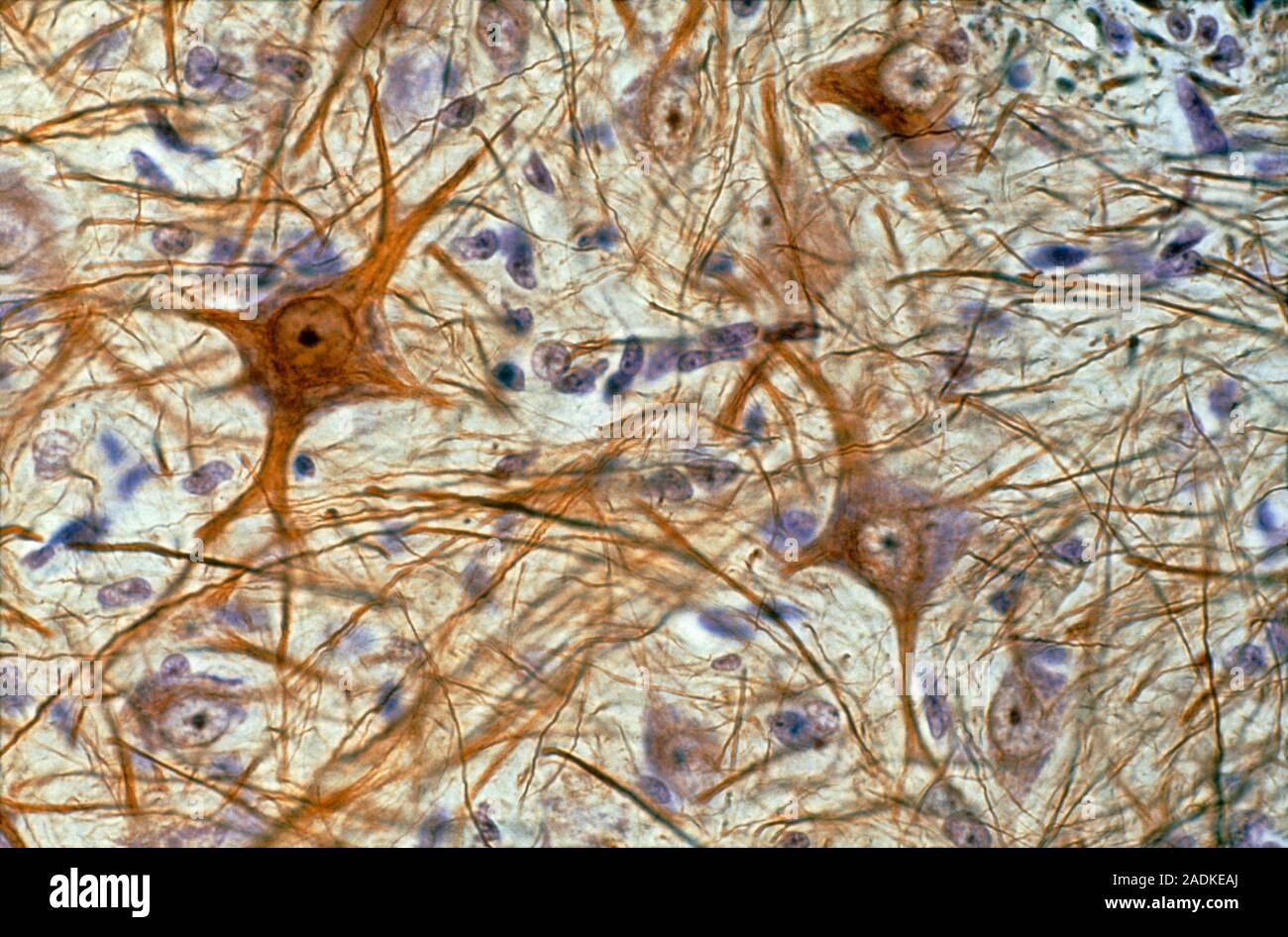 Les tissus du cerveau. Microphotographie lumière d'une section couper à ...