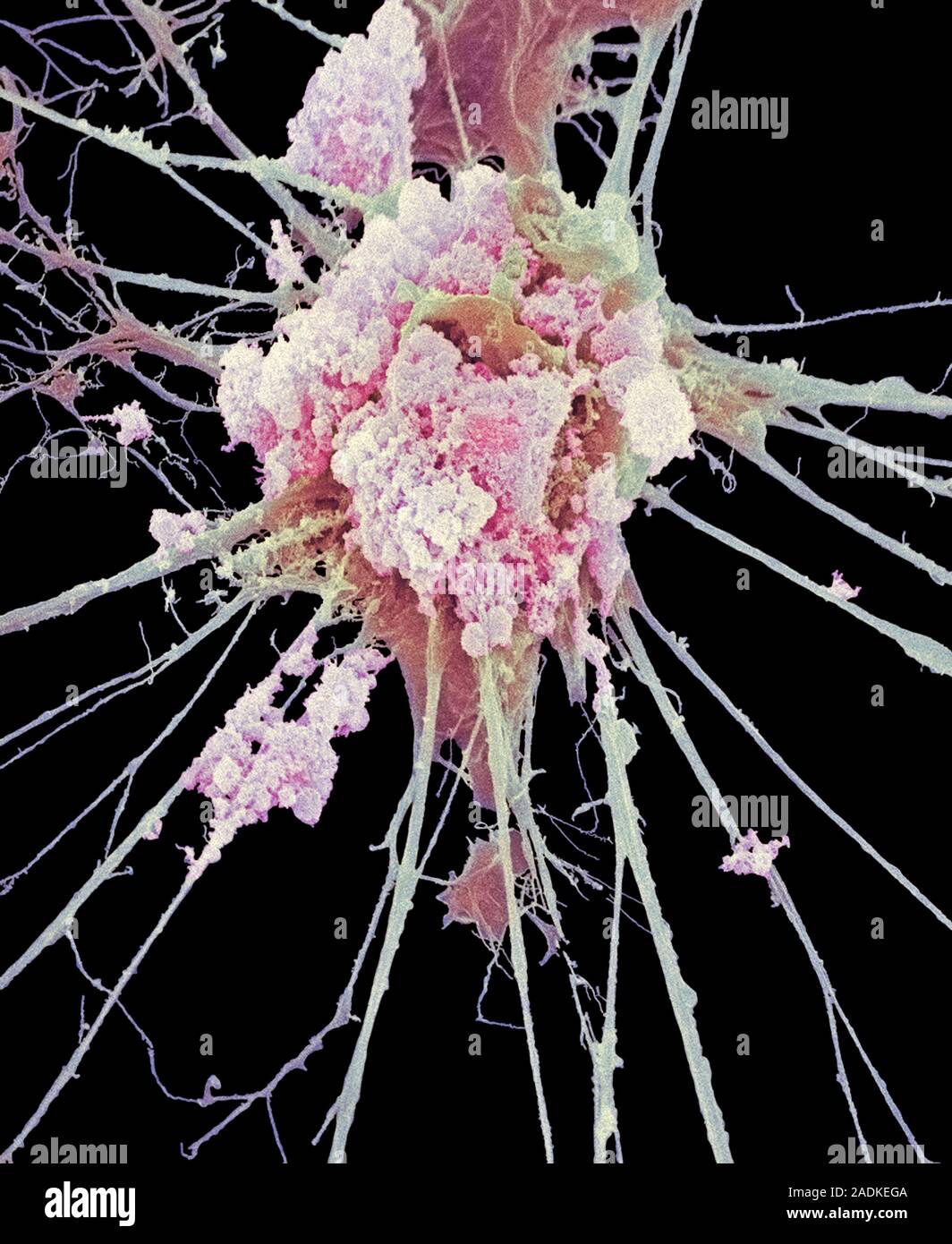 Cellule nerveuse. Couleur de l'analyse des électrons Microphotographie ...