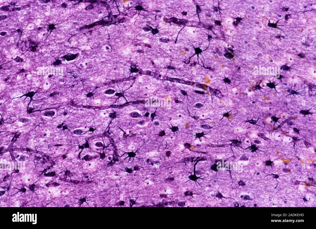 Les cellules nerveuses. Microphotographie lumière d'une section à ...