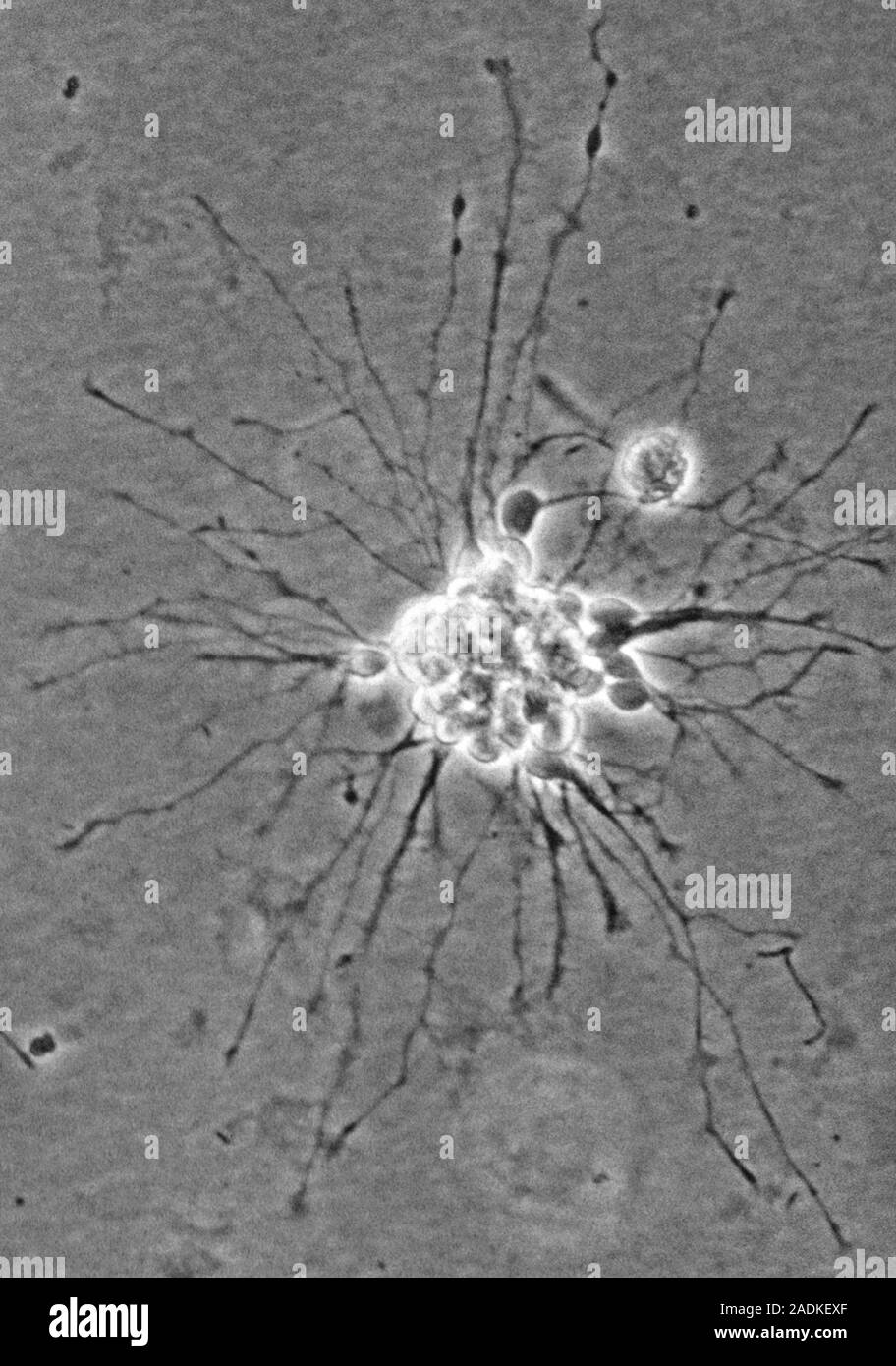 La croissance des cellules nerveuses. Micrograph Light d'un 1 semaines ...