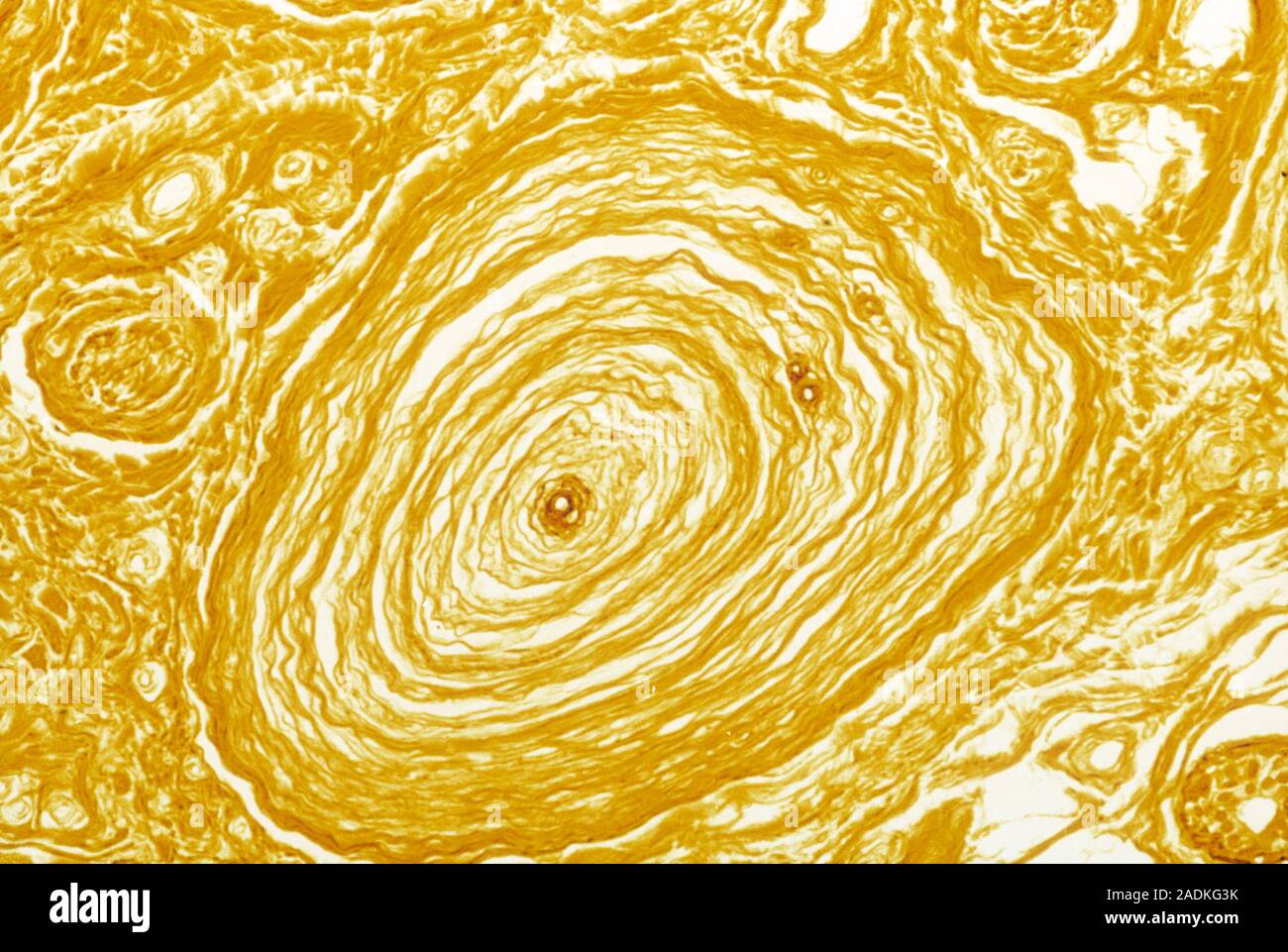 Micrograph Light d'un Pacinian corpuscule (centre), un récepteur ...