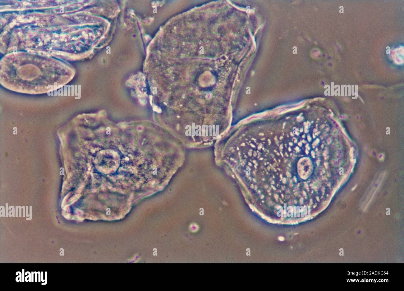 Les cellules de la joue. Micrograph Light l'épithélium pavimenteux de ...