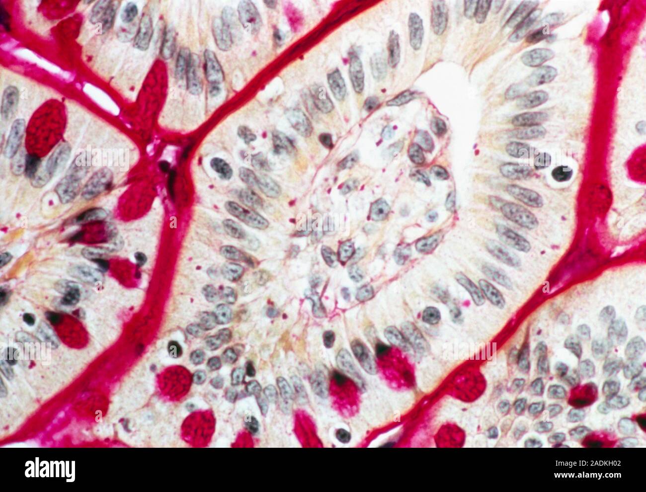 Des villosités intestinales. Micrograph Light d'une section ...