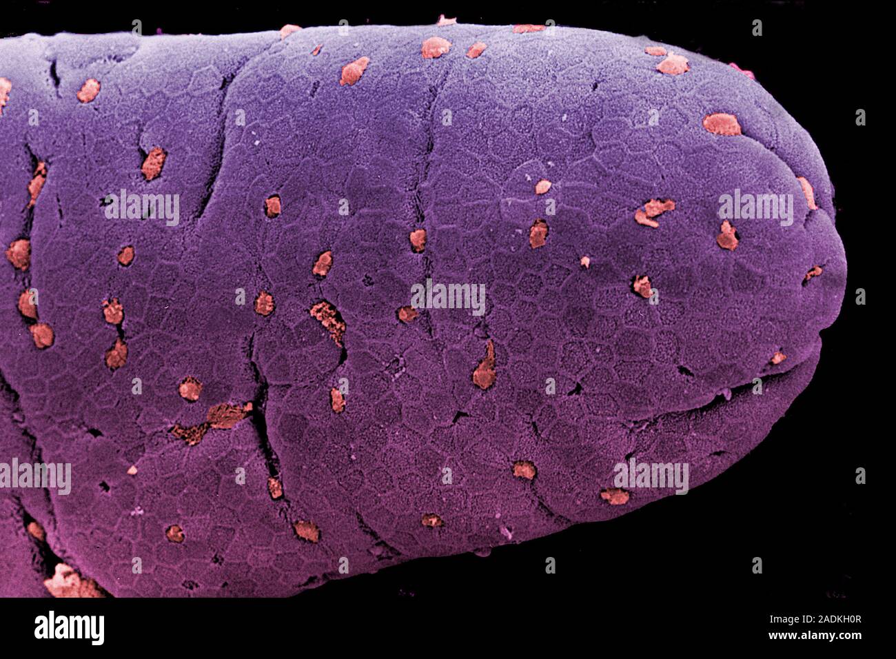 Des villosités de l'intestin grêle. Couleur de l'analyse des électrons ...