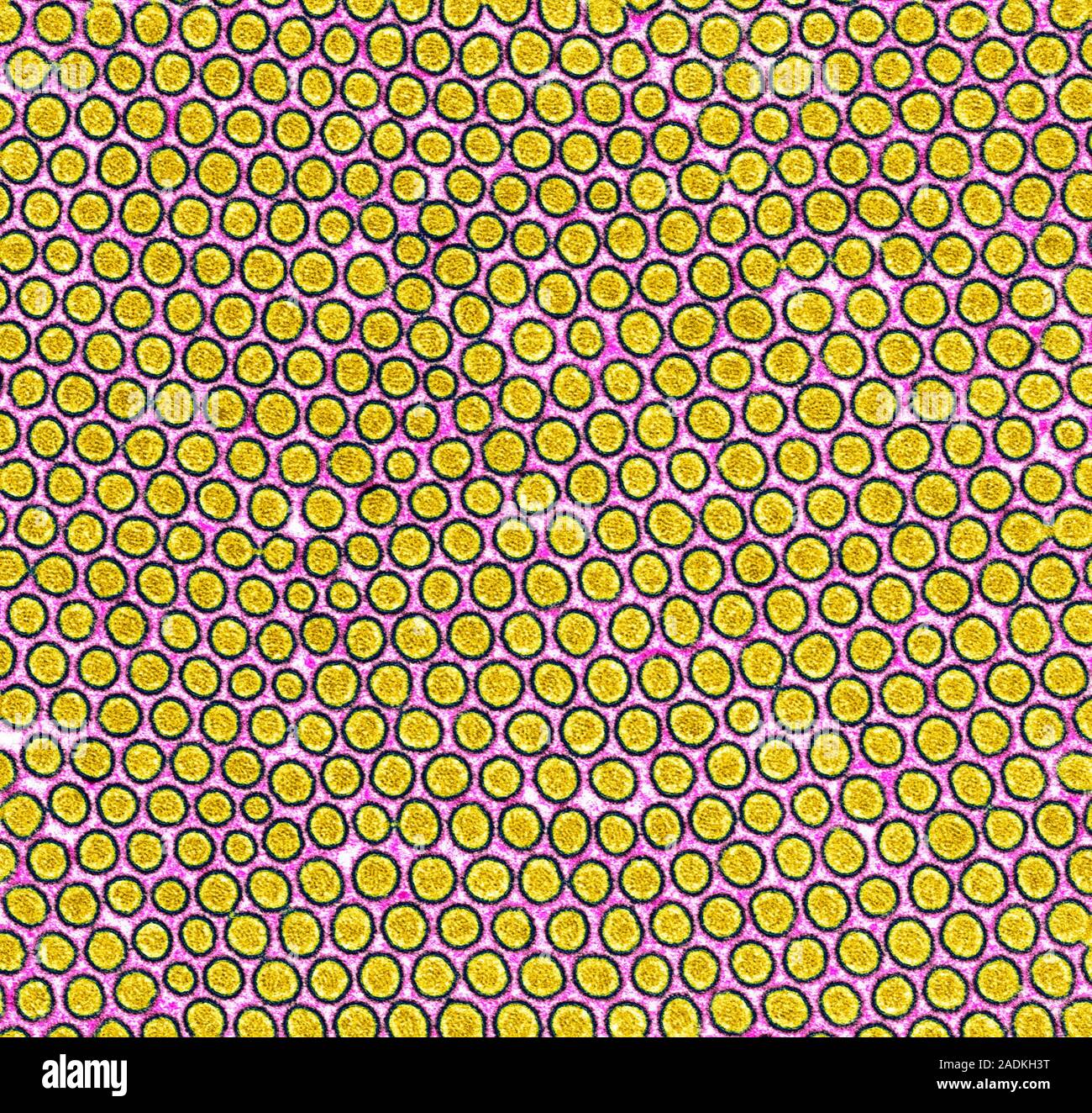 Les microvillosités intestinales. Micrographe de couleur (MET) de ...