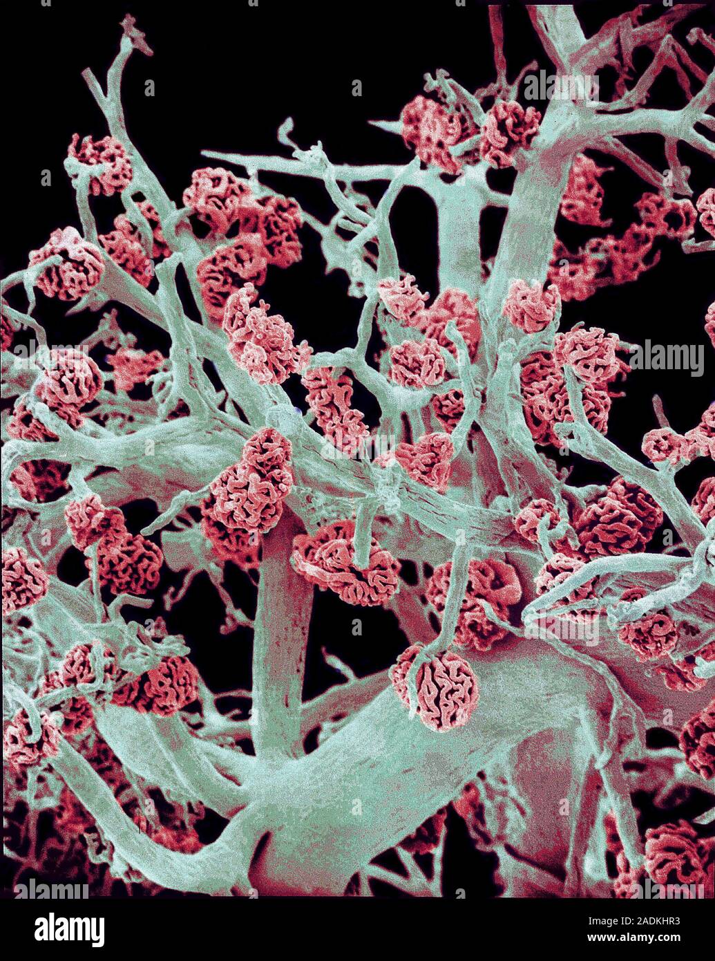 Les vaisseaux sanguins des reins. Couleur de l'analyse des électrons ...