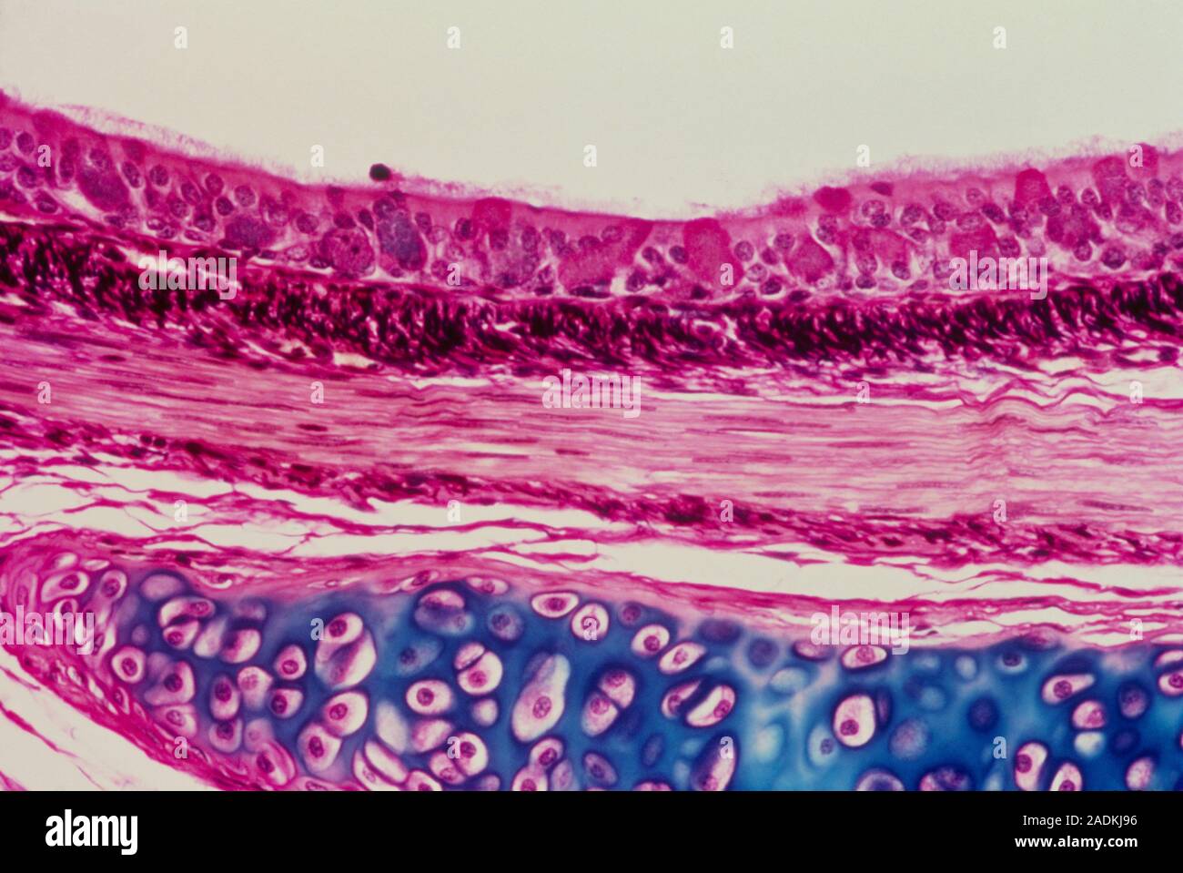 Bronche pulmonaire. Microphotographie lumière d'une coupe transversale ...