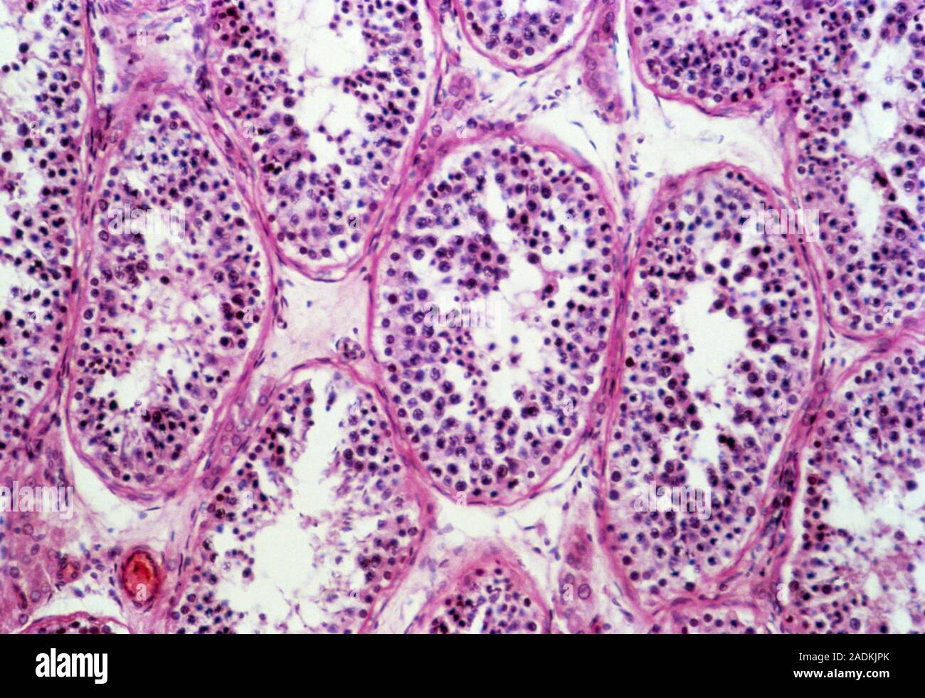 Microphotographie lumière d'une section à travers un testicule humain ...
