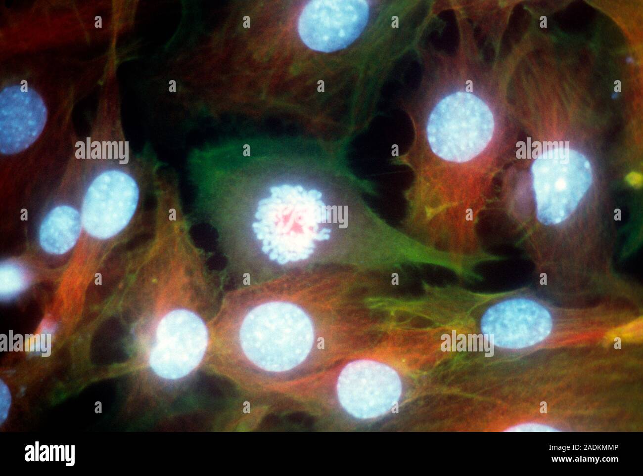 La mitose. Micrographie de lumière par immunofluorescence des cellules ...