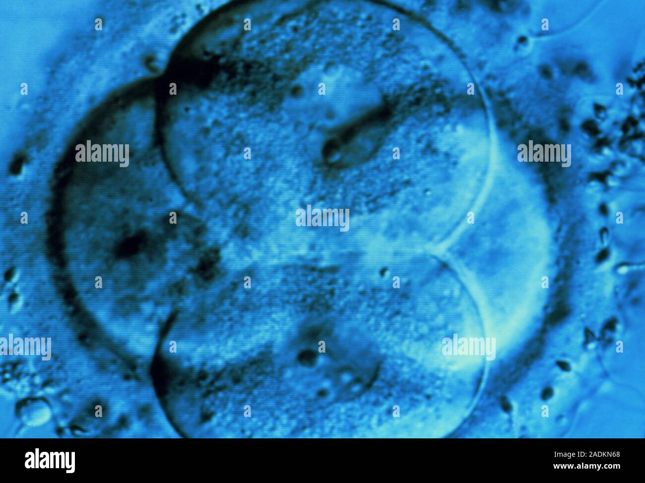 Quatre cellules de l'embryon. Micrographie de lumière d'un début, stade ...
