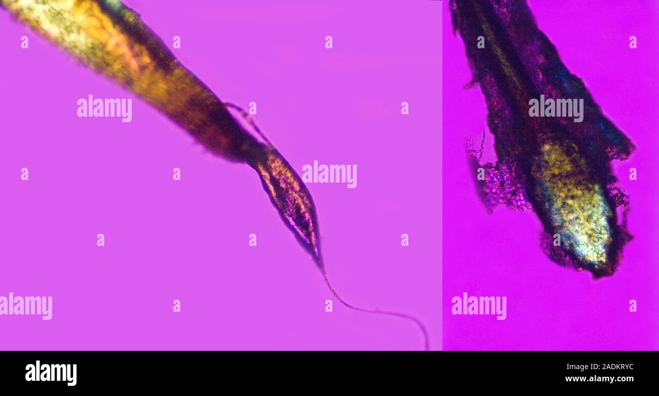Follicule de cheveux morts et vivants des échantillons. La lumière ...