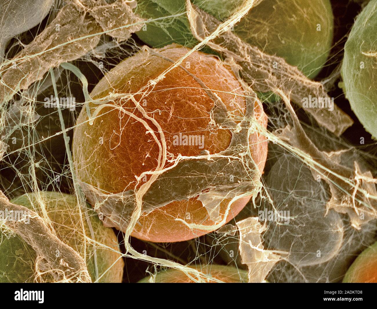 Les cellules de graisse. Couleur de l'analyse des électrons ...