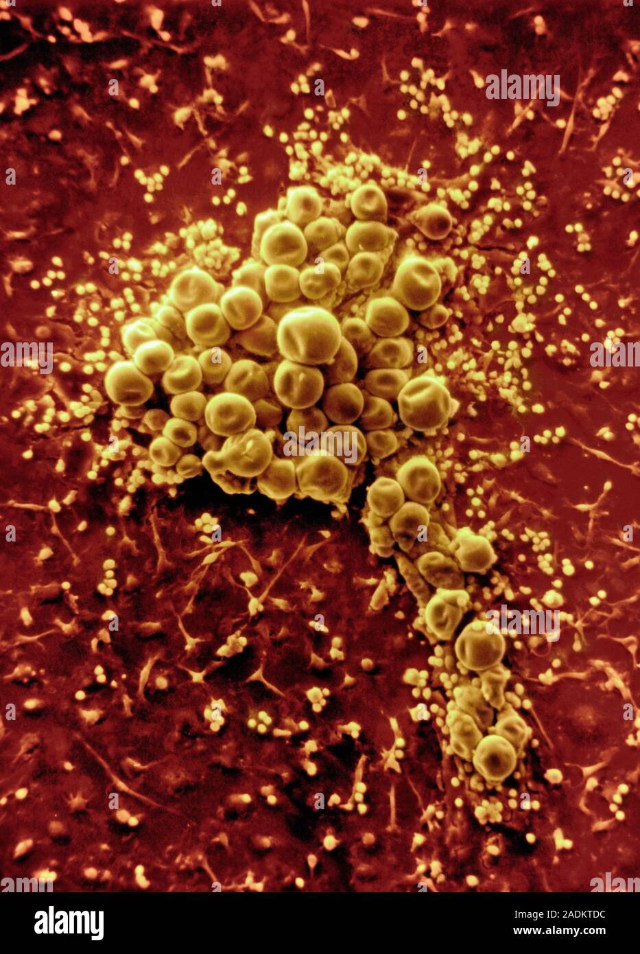 Les cellules adipeuses. Couleur de l'analyse des électrons ...