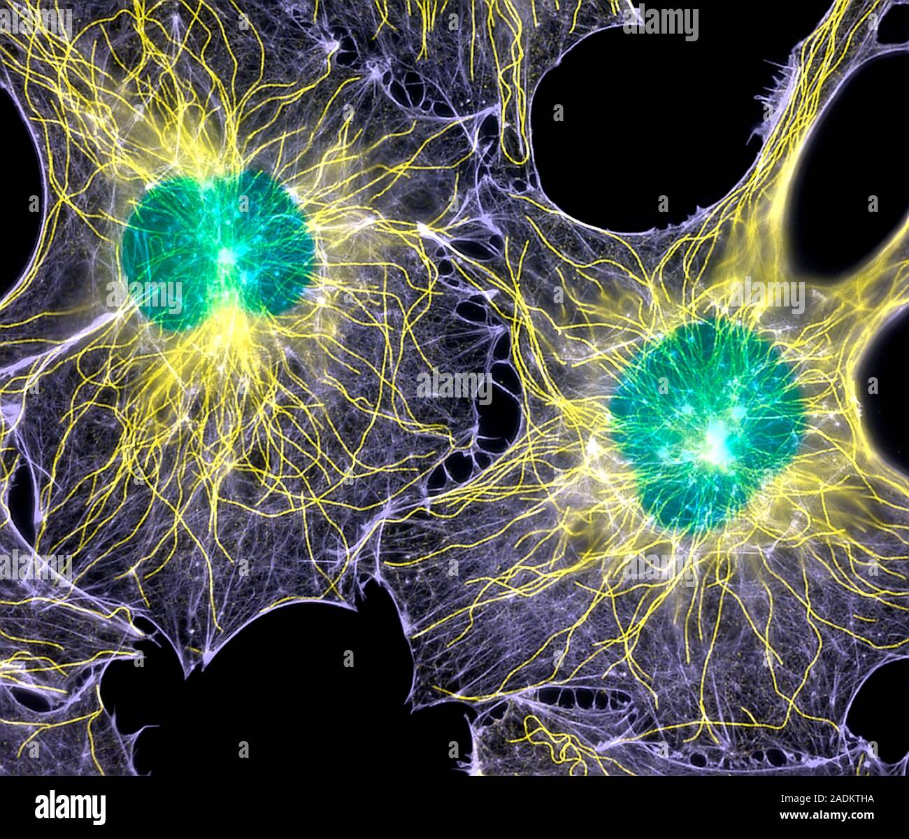 Les cellules fibroblastes. La lumière fluorescente de deux cellules ...