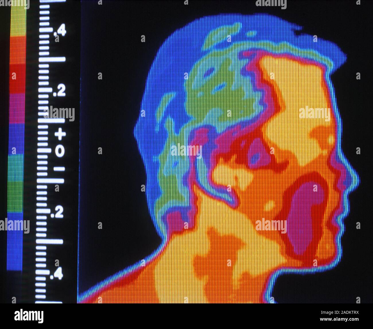 Septembre 2006 d'un thermogramme tête. La thermographie est une ...