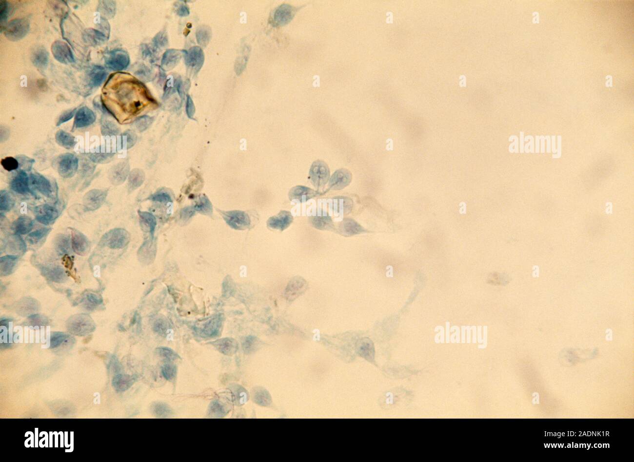 Les parasites Giardia intestinalis (précédemment G. lamblia ...
