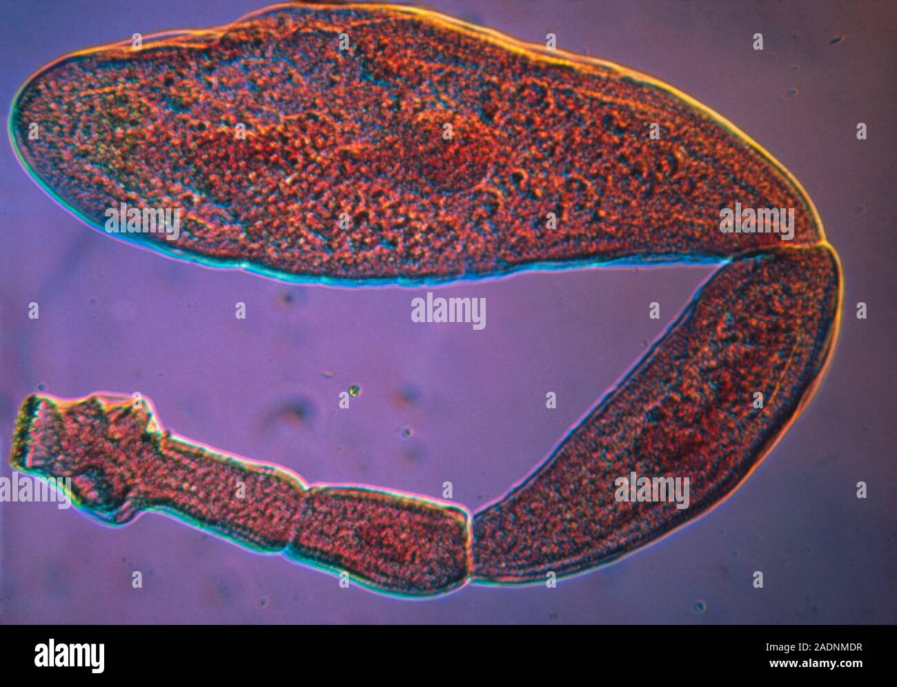 Le ténia. Micrograph Light d'un chien, ténia Echinococcus granulosus ...