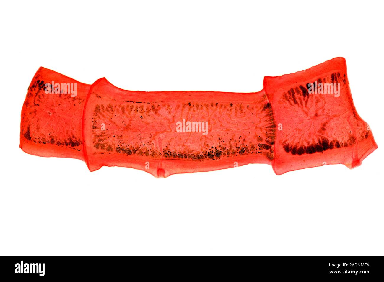 Le ver. Micrograph Light d'une section à travers le corps d'un ténia du ...