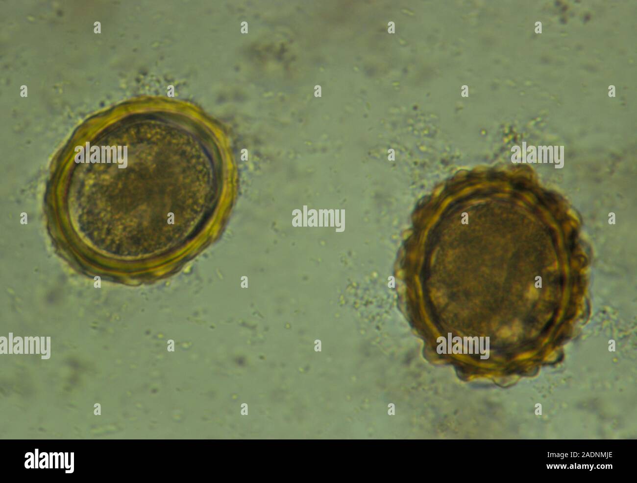 Les œufs de nématodes. Microphotographie lumière de deux oeufs du ver ...