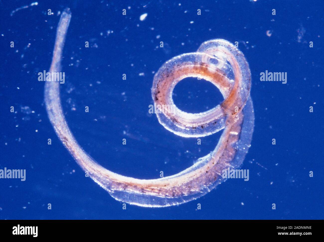 Les ankylostomes parasite. La lumière Microphotographie d'un homme ...