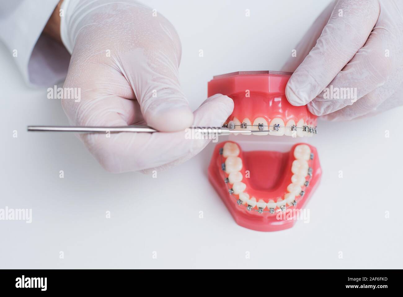 Le médecin montre comment le système de crochets sur les dents est ...