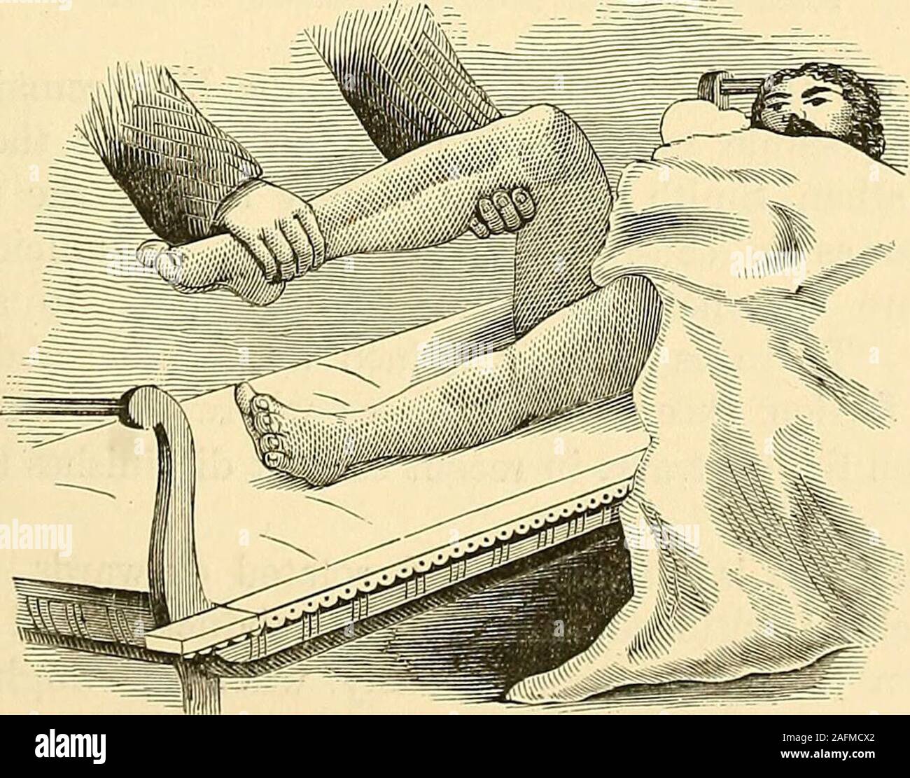 Ligament ilio fémoral Banque de photographies et d’images à haute ...