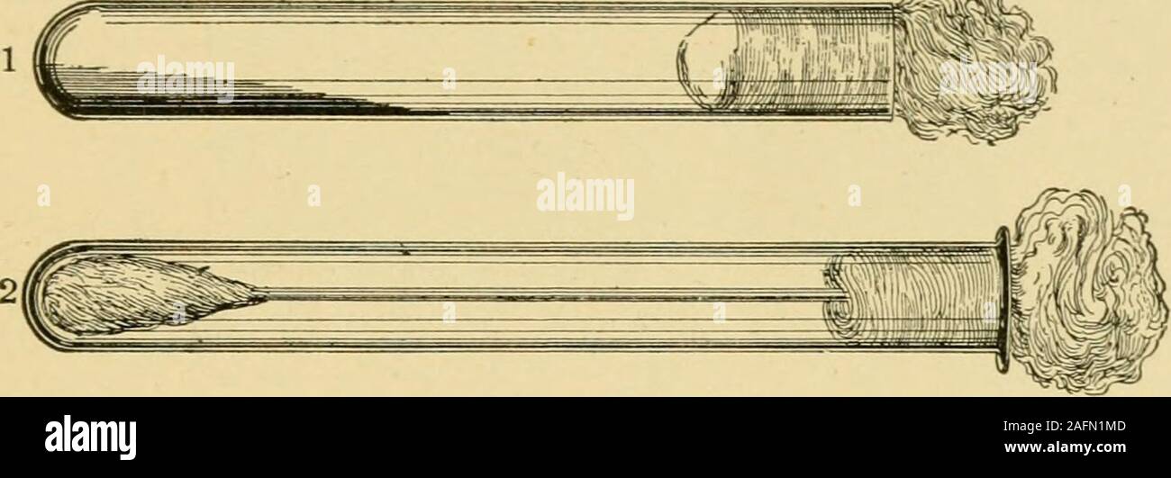 Angine de vincent Banque de photographies et d’images à haute ...