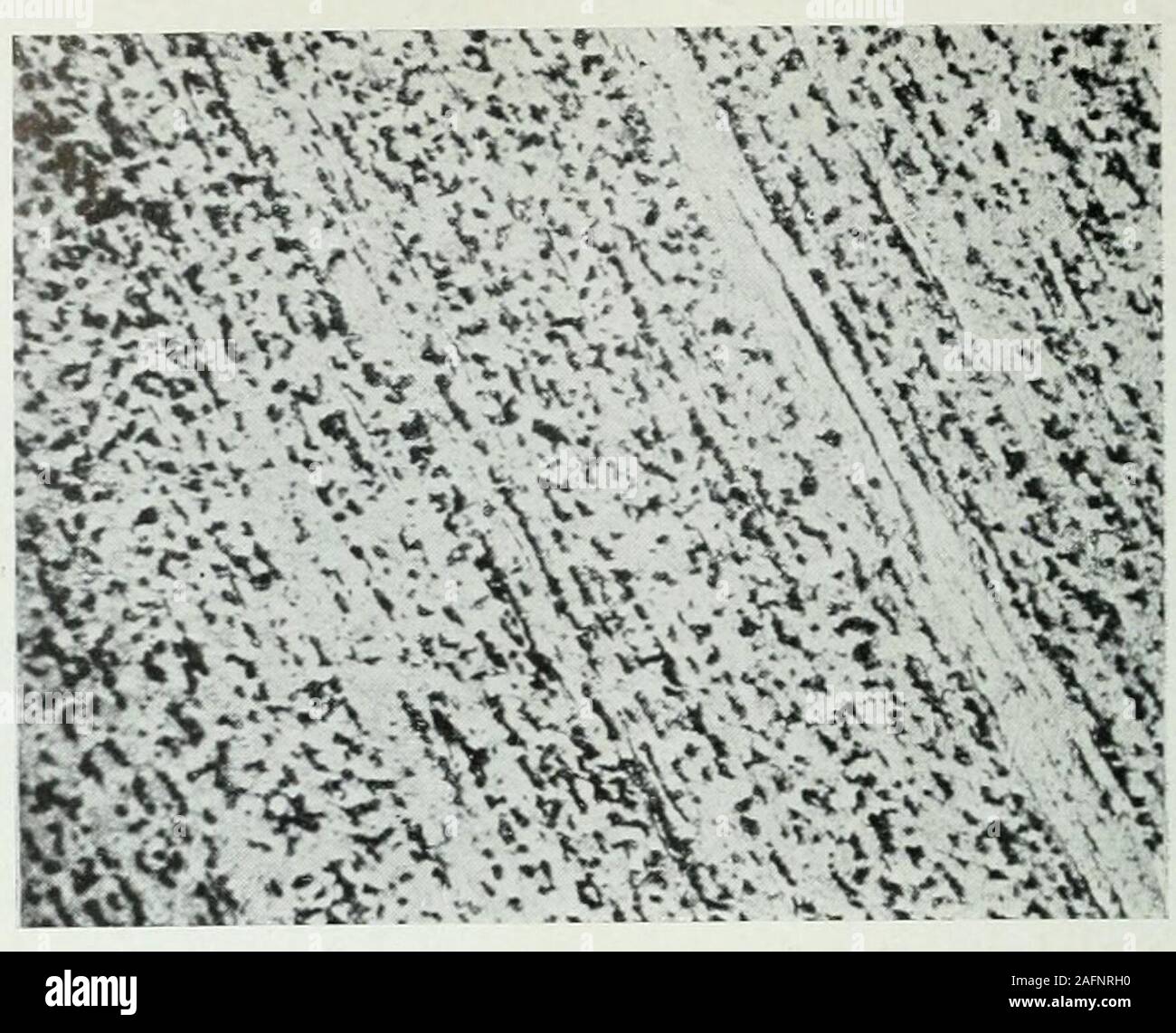 Acier au carbone microstructure Banque de photographies et d’images à ...