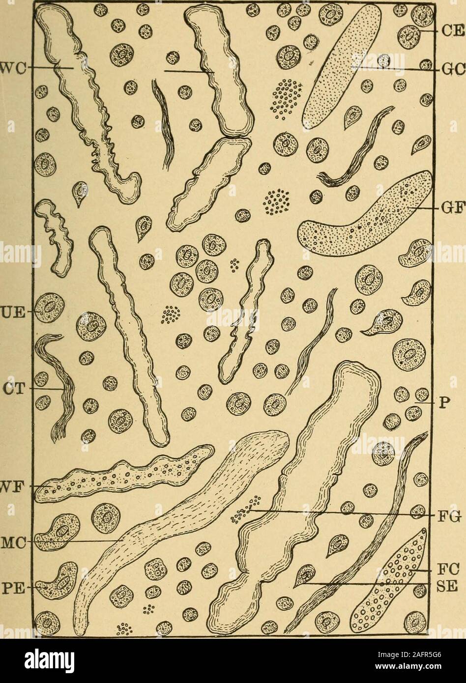 . L'analyse urinaire et le diagnostic par examen microscopique et ...