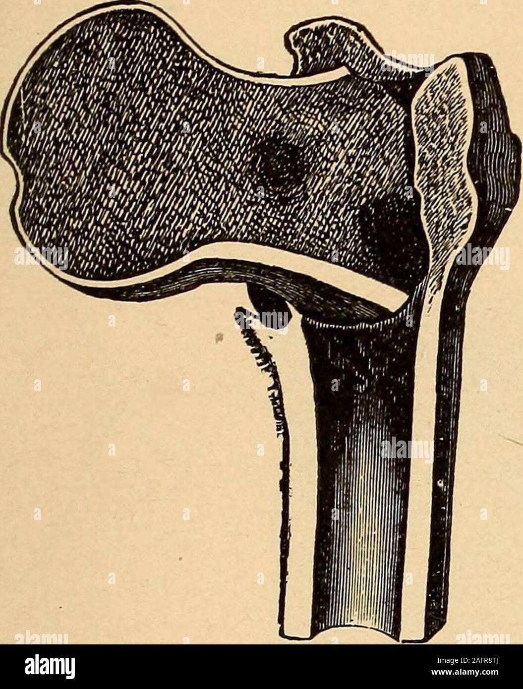 Abduction adduction Banque de photographies et d’images à haute ...