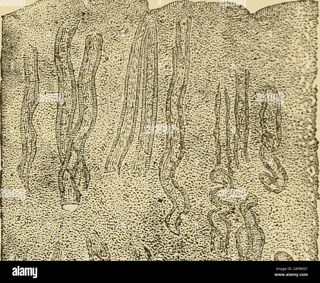 . Cyclopaedia de l'obstétrique-gynécologie. agrandie. (Modèle du Dr ...