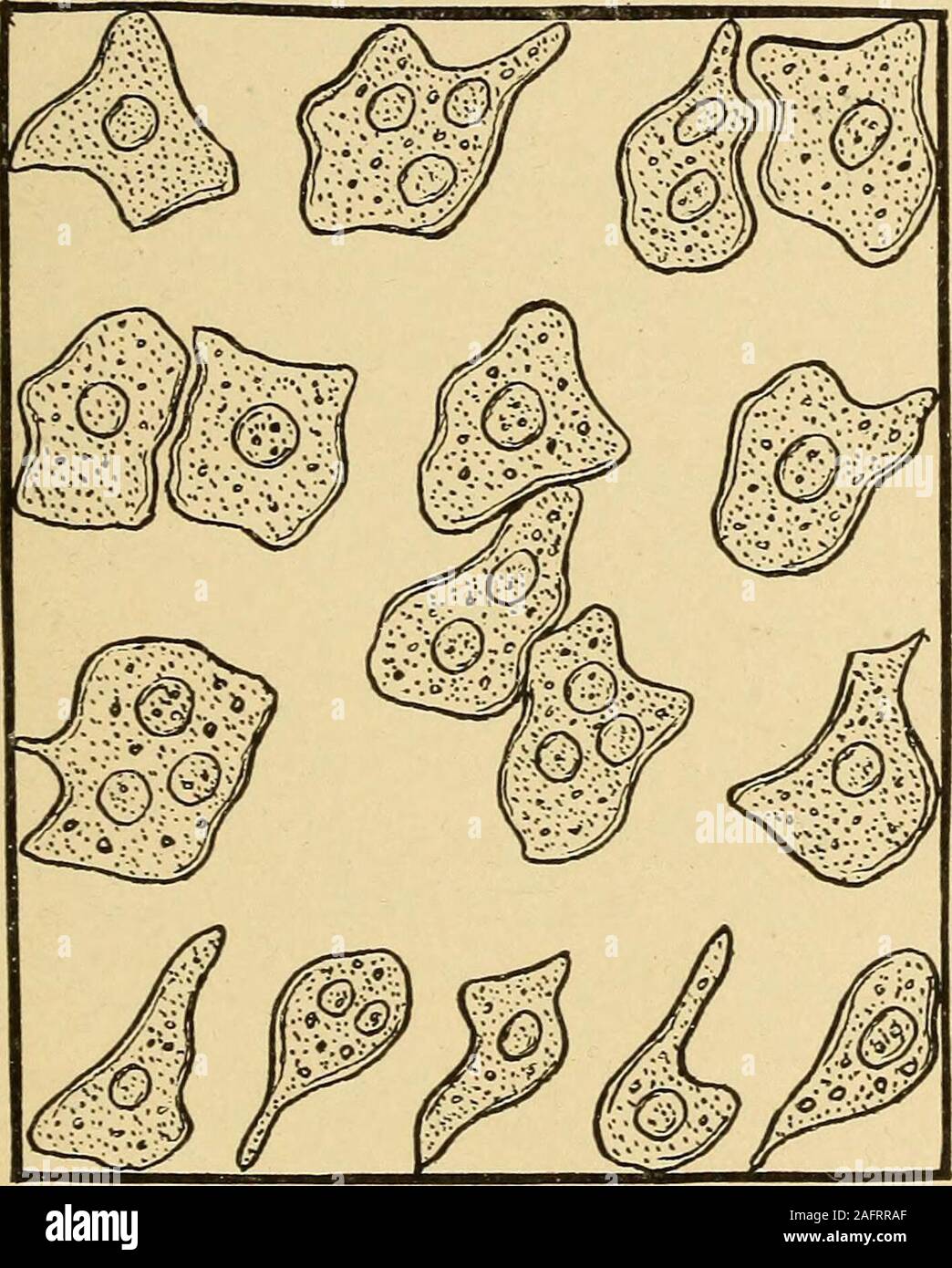 L Analyse Urinaire Et Le Diagnostic Par Examen Microscopique Et