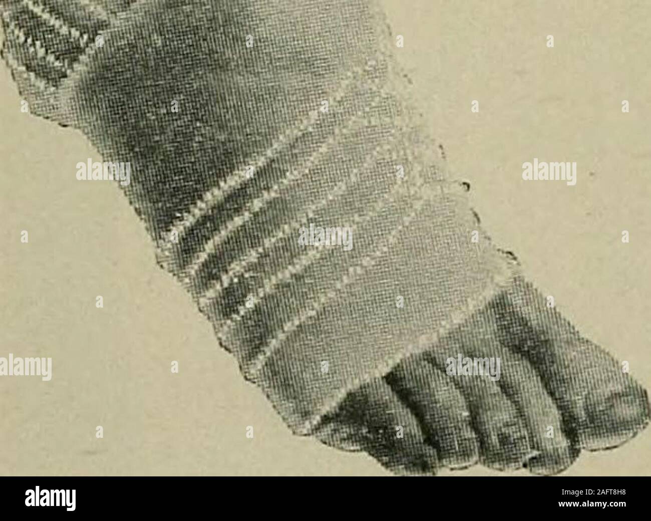 Spica Bandage Banque d'image et photos - Alamy
