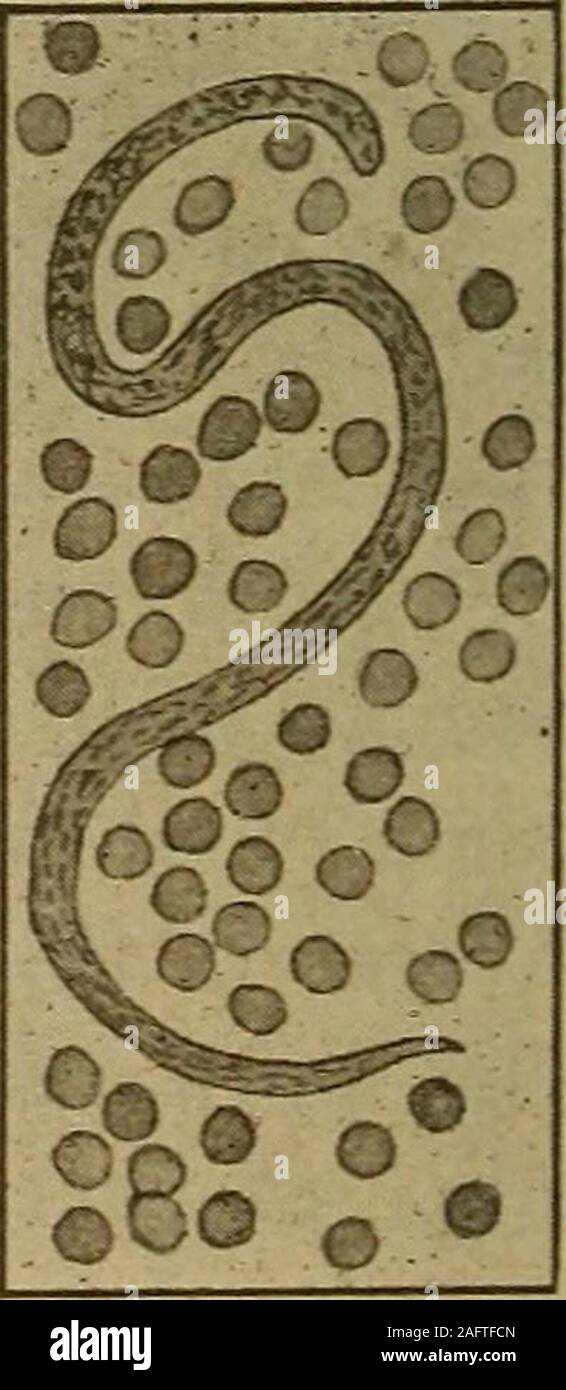 Loa loa filaria Banque de photographies et d’images à haute résolution ...