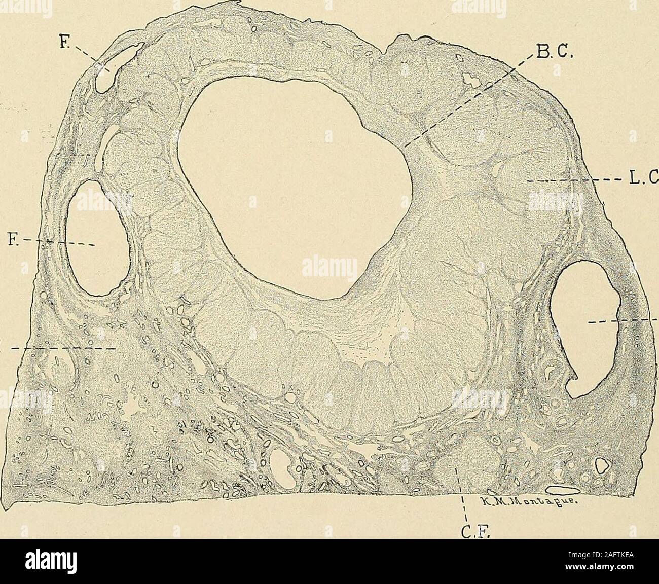 . Le diagnostic et le traitement des maladies des femmes. Fig. 650 ...