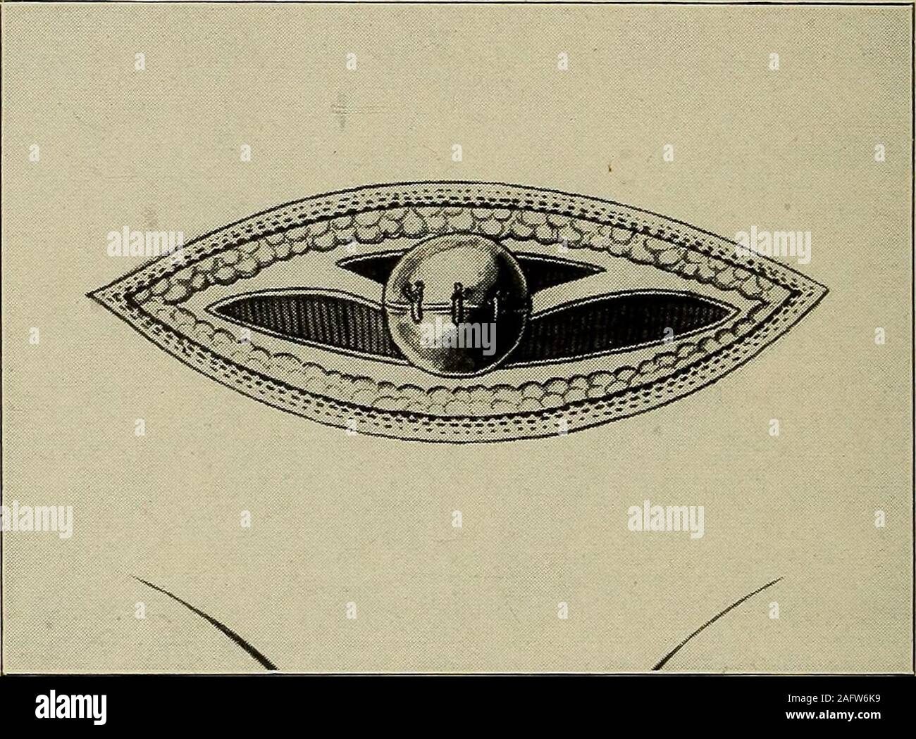 Aponevrose cervicale Banque de photographies et d’images à haute ...