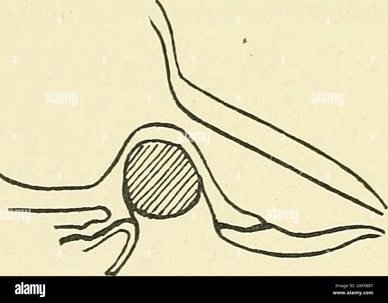 . Des études sur l'hypertrophie et le cancer de la prostate. Fig. 31 ...