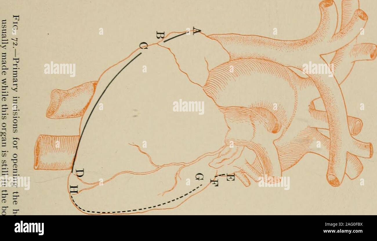 Intervalle post mortem Banque de photographies et d’images à haute ...