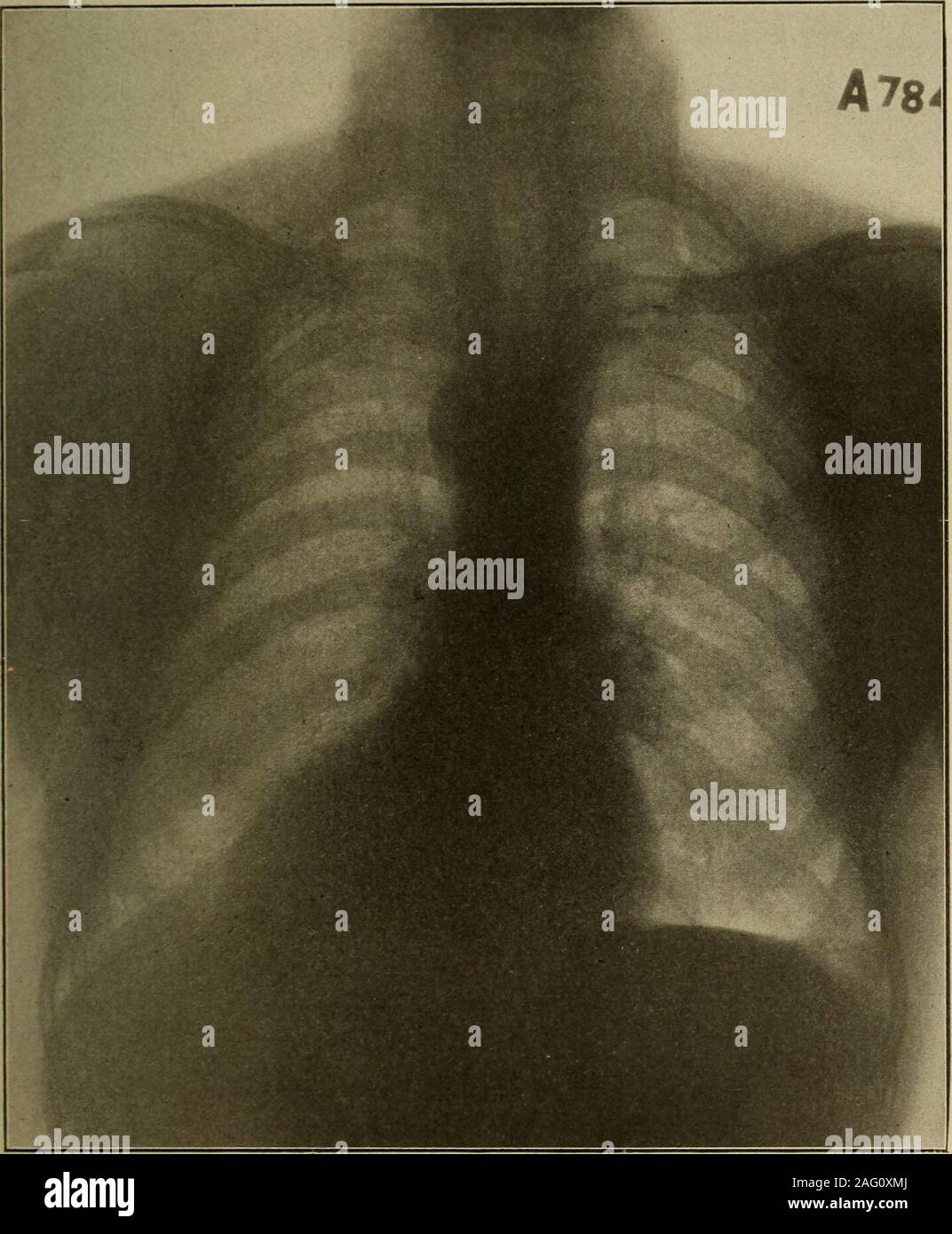 . Diagnostic médical pour l'étudiant et le praticien. Fig. 291 ...