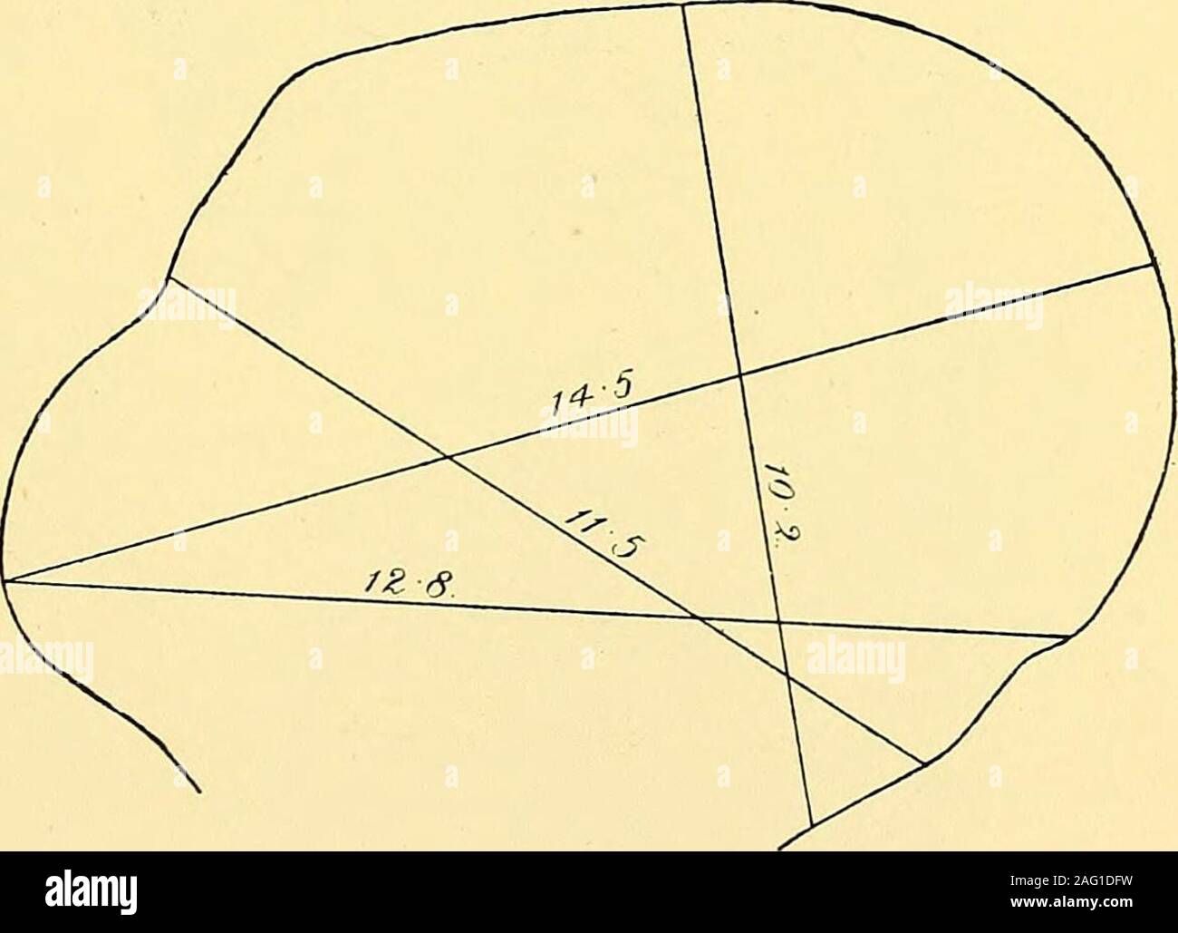 Squamous suture Banque de photographies et d’images à haute résolution ...