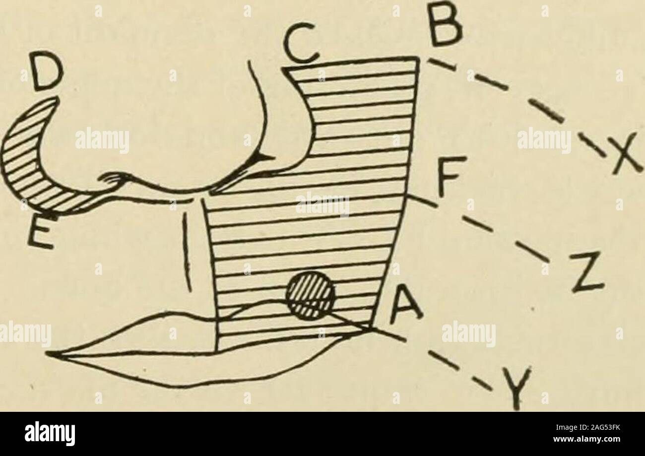 Incision cervicale Banque de photographies et d’images à haute ...