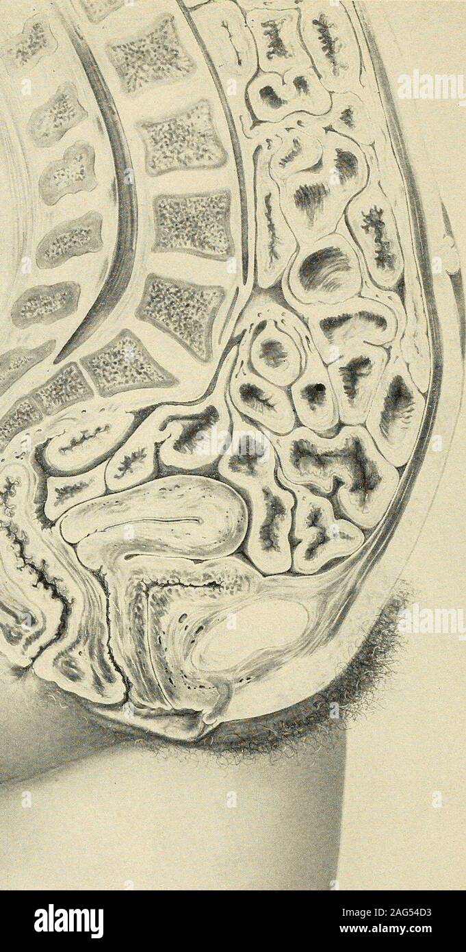 . Le diagnostic et le traitement des maladies des femmes. La ...