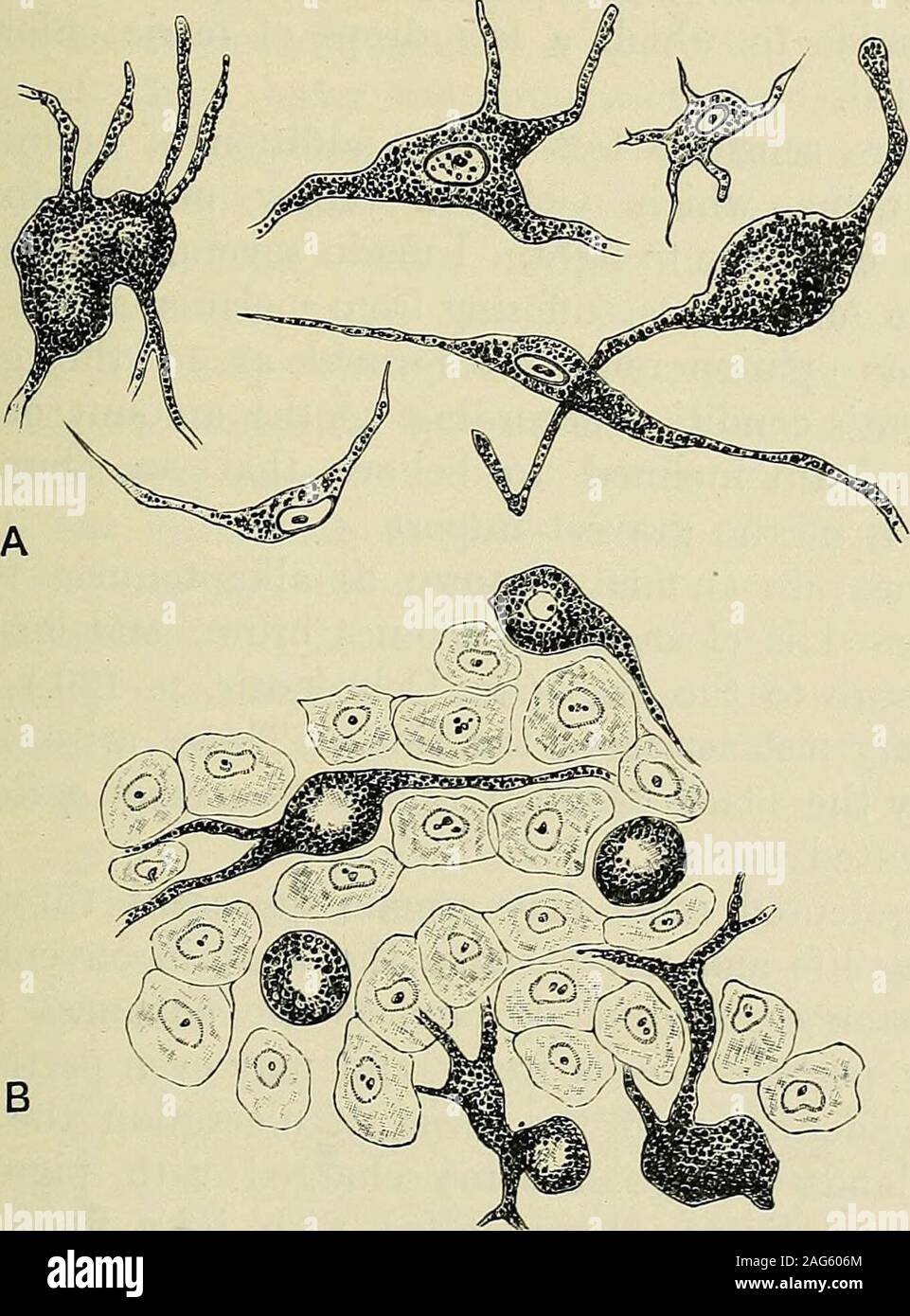 Tumeurs de la peau Banque de photographies et d’images à haute ...