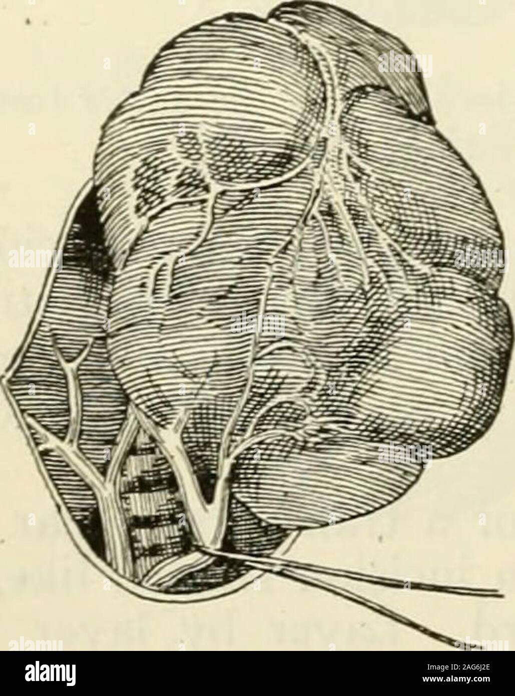 Recurrent nerve Banque de photographies et d’images à haute résolution ...